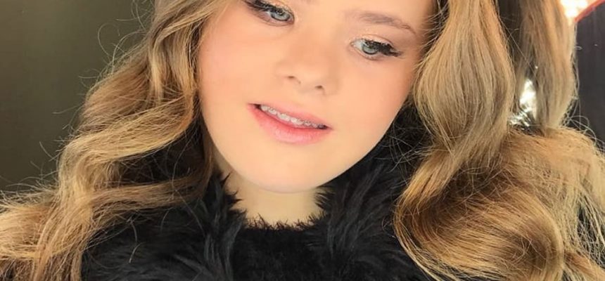 Modelo brasileira com síndrome de Down é capa de revista australiana ...